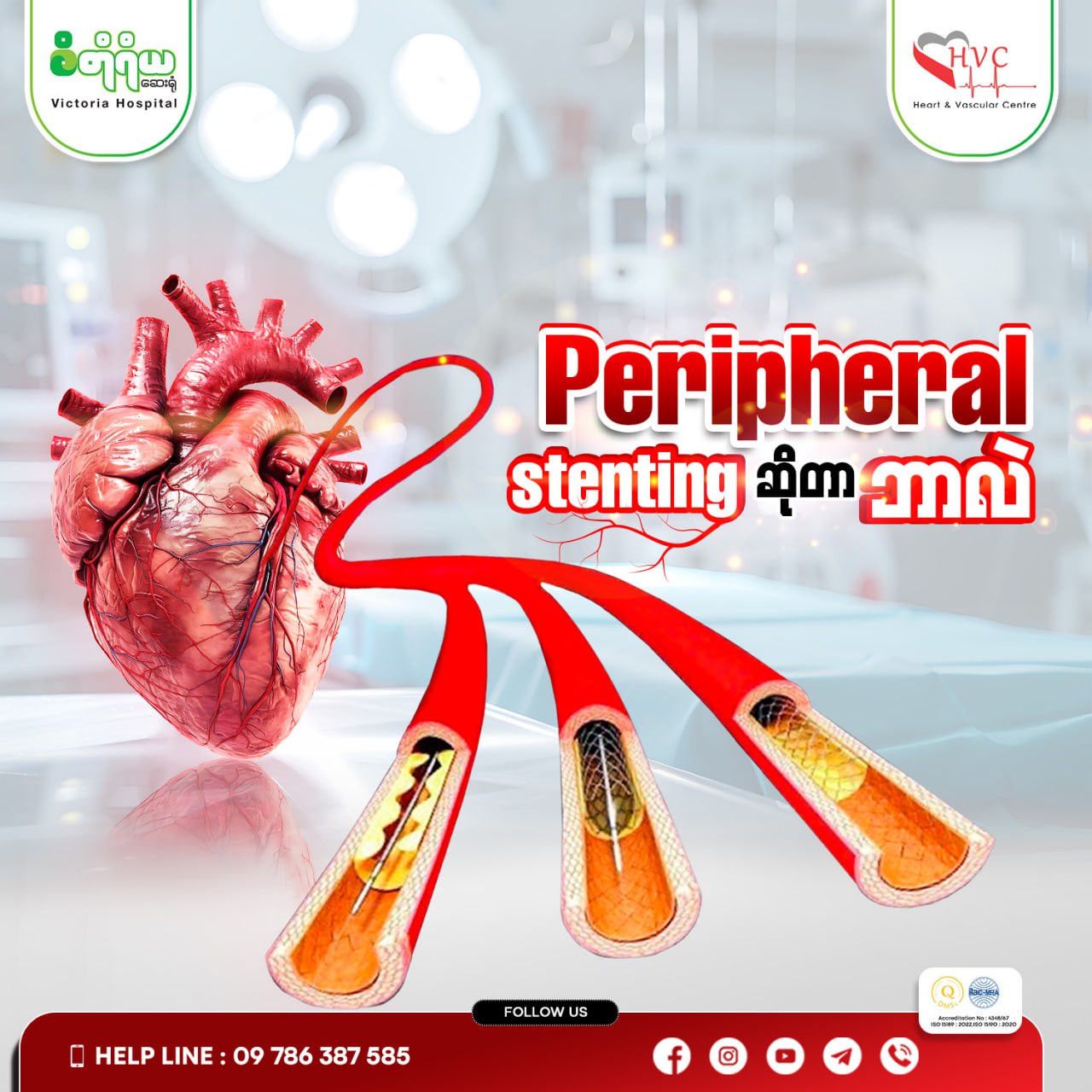 What is Peripheral Stenting? - Victoria Hospital Myanmar